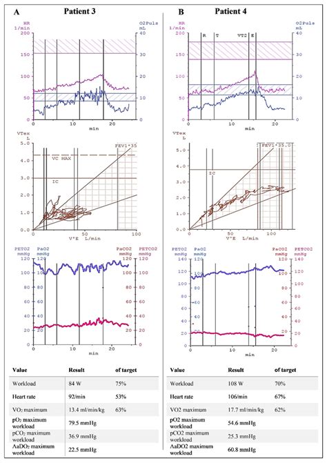 Cardiopulmonary Exercise Testing Of A Patient With Download Scientific Diagram