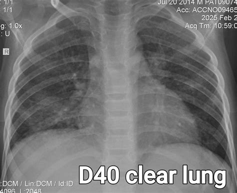 មូលនិធិគន្ធបុប្ផាកម្ពុជា Cambodia Kantha Bopha Foundation Added A New