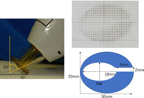 Laser Treatment With CSC Was Performed At An Angle Of 45 Degrees Download Scientific Diagram