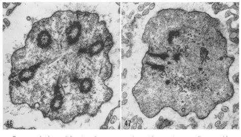 Figure 8 From Olfactory Cilia In The Frog Semantic Scholar