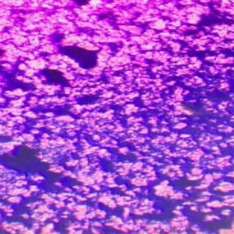 macroscopic view of the slide in positive superagglutination test download scientific diagram