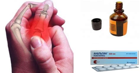 ჩაყარეთ 2 აბი ანალგინი იოდში და სამუდამოდ დაივიწყეთ სახსრების ტკივილი