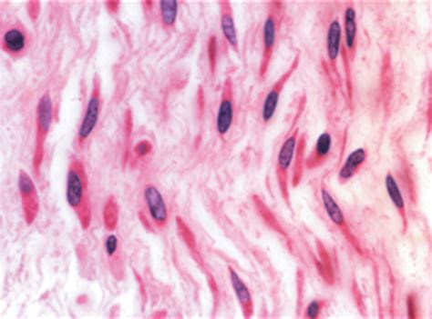 Histology Lecture 7 Connective Tissue Pictures Flashcards Quizlet