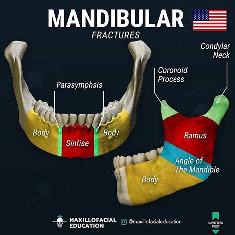 Condyloid Process And Mandibular Condyle