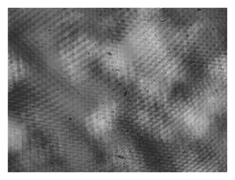 The Sequent Patterns Of The Dual Scan Laser Speckle Interferometry Download Scientific Diagram