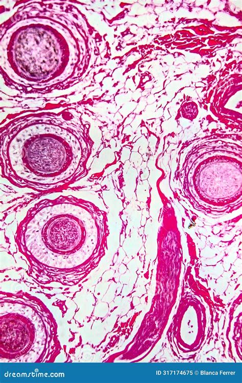 Photomicrograph Of Human Large Intestine Under Microscope Stock Image 318774529