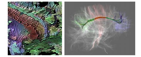 Vcg Harvard Visualization In Connectomics