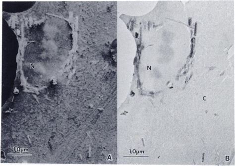 Scanning Electron Micrograph I And The Corresponding Backscatter