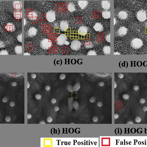 Flow Diagram For The Detection Based Stomata Extraction Download Scientific Diagram