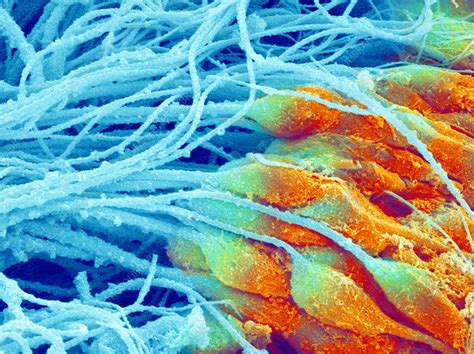 Sperm Production SEM Stock Image P Science Photo Library