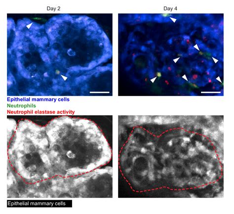 Longitudinal Intravital Imaging Through Clear Silicone Windows