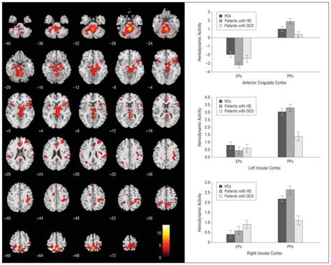 Here S What Clutter Does To Your Brain And How To Fix It