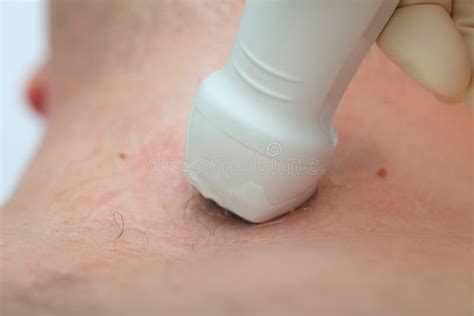 Ultrasonic Test Of Male Patient Stock Image Image Of Check Carotid