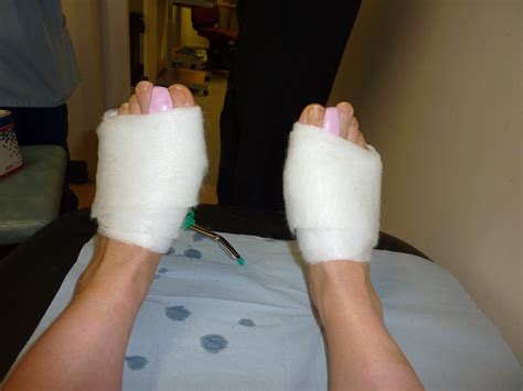 Casts And Feet And More
