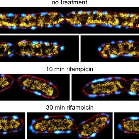 Nucleoid Organization In The Insect Pathogen Xenorhabdus Doucetiae Download Scientific Diagram