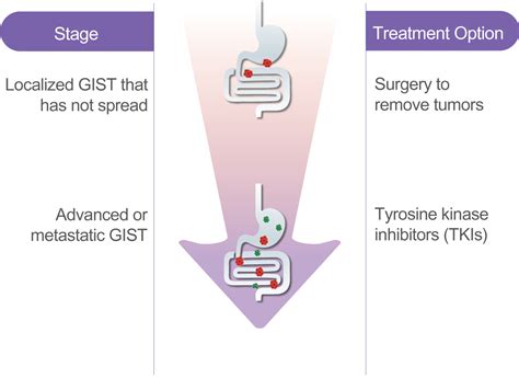 主頁 活出新基 樂在其中 Gastrointestinal Stromal Tumor Gist