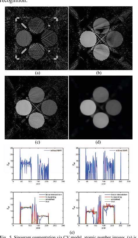 Figure 5 From Metal Artifact Reduction In Dual Energy Ct By Sinogram Segmentation Based On