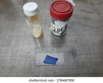 Lpcb Images Stock Photos D Objects Vectors Shutterstock