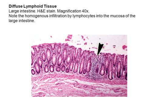 Lymphoid Or Lymphatic Tissues Which Mainly Consist Of Dense