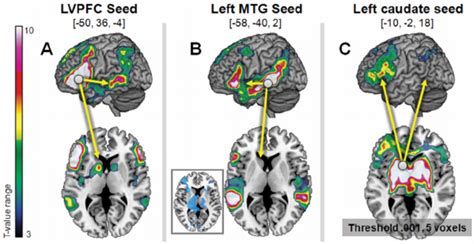 Resting State Seeds And Single Seed Resting Connectivity Analyses Maps Download Scientific Diagram
