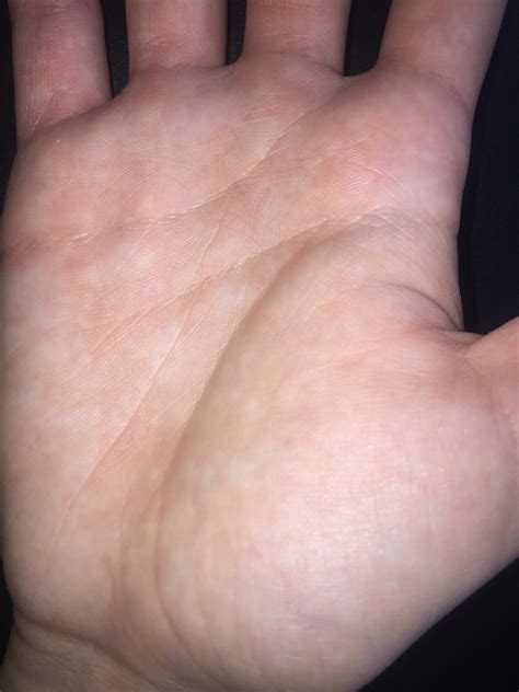 Life Line Classification Instance Segmentation Dataset And Pre Trained