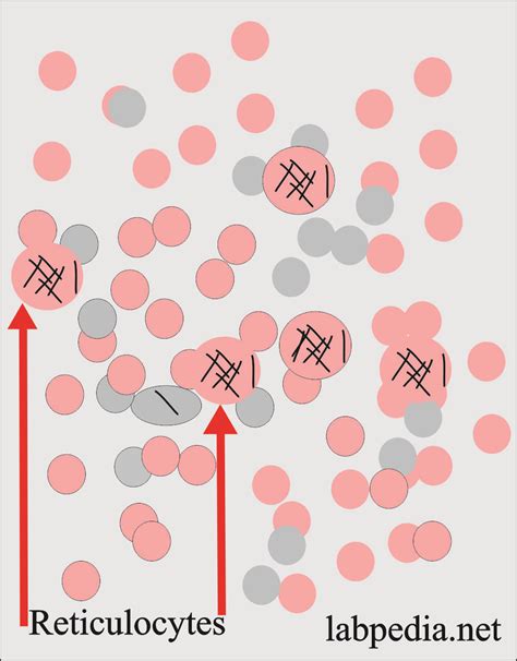 Reticulocyte Count Retic Count And Interpretations
