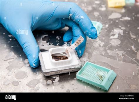 Scientist Embedding Tissues In Paraffin Blocks For Sectioning Pathology Laboratory Cancer