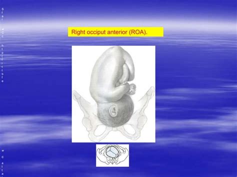 Mechanism Of Labour Normal And Abnormal Ppt