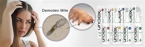 Demodex Mites Treatment Affect Human Hair Skin Face Ungex