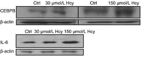 western blot assay for validation of microarray data at protein levels