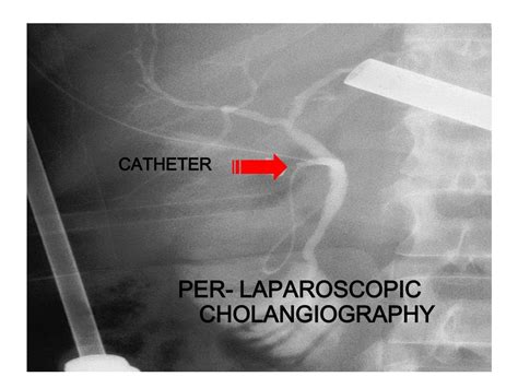 Ppt Gall Bladder Powerpoint Presentation Free Download Id3584786