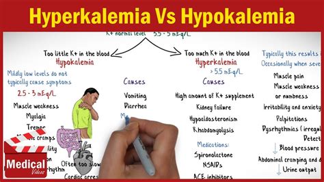 Hypokalemia