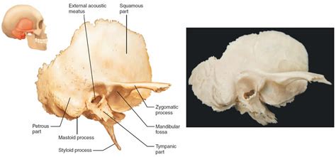 temporal bone anatomy parts of temporal bone and temporal bone fracture