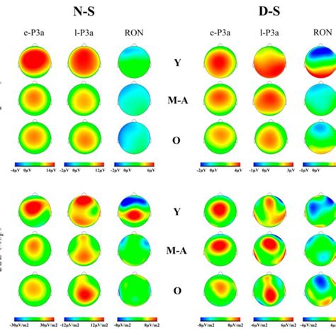 Voltage Maps And Current Source Density Csd For E P3a L P3a And