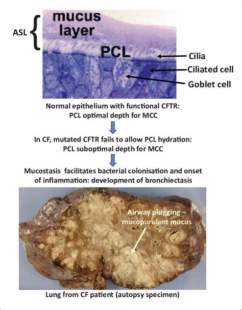 Relative Locations Of The Gel Like Mucus Layer And Pcl Components Of