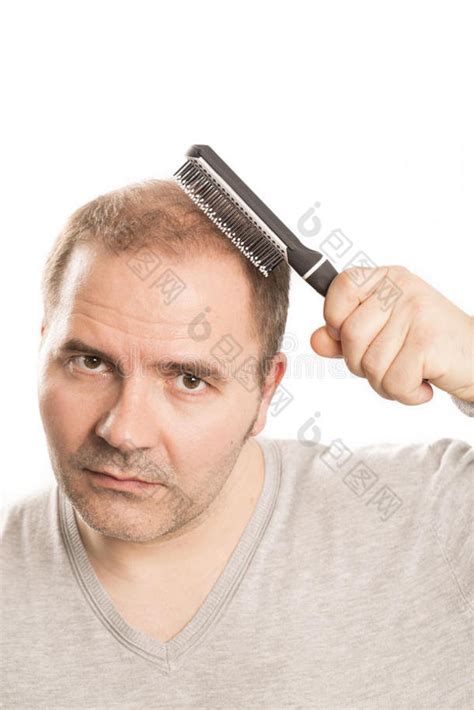 秃顶脱发脱发脱发脱发图片 包图网企业站