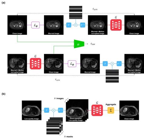 Simultaneous Super Resolution And Motion Artifact Removal In Diffusion Weighted Mri Using