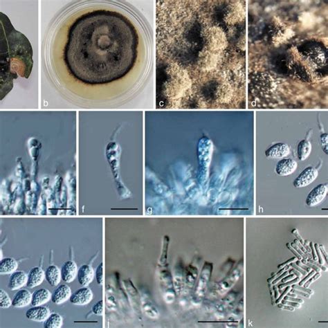 Phyllosticta Hostae A Appearance Of Conidiomata On Host Leaf Surface