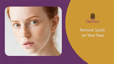 Remove Spots On Your Face Quick And Easy Ways AgromedBotanic