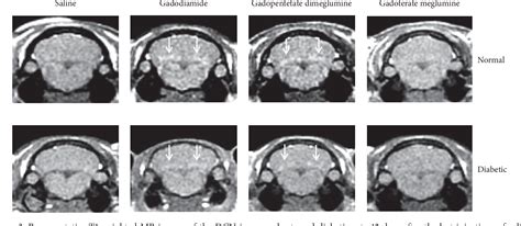 Figure 3 From Gadolinium Retention And Clearance In The Diabetic Brain After Administrations Of