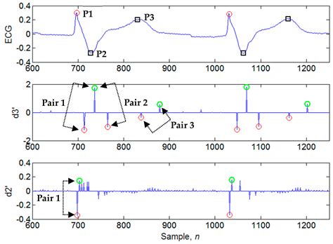 Applied Sciences Free Full Text A Novel Wavelet Based Algorithm For Detection Of Qrs Complex