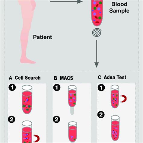 Illustration Of Ctc Isolation Methods By Magnetic Separation Using