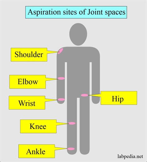 Fluid Analysis Part 8 Synovial Fluid Analysis Procedure For