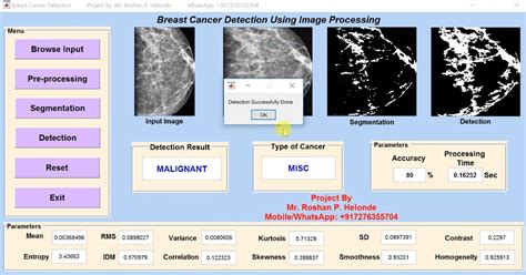 Types Of Breast Cancer Detection Using Matlab Project Source Code ~ Engineering Projects