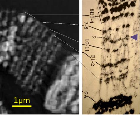 Comparison With Electron Microscopy Shows That Every Known Band Can Download Scientific