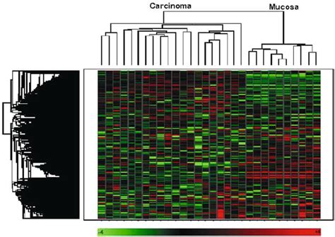 Hierarchical Cluster Analysis Of Gene Expression Values From Colorectal