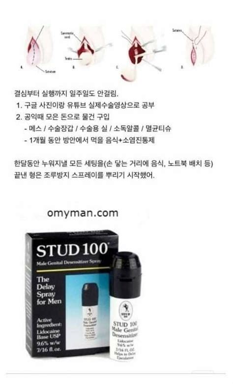 사촌형이 고자된 썰 푼다 OP GG