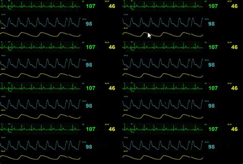 multi threaded drawing · issue 3643 · lvgl lvgl · github