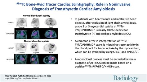 Radiology Vol 306 No 2