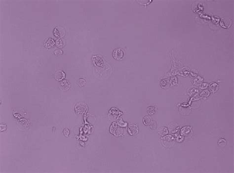 Comparison Of Cell Morphology Before And After Exposure To H2O2 Download Scientific Diagram